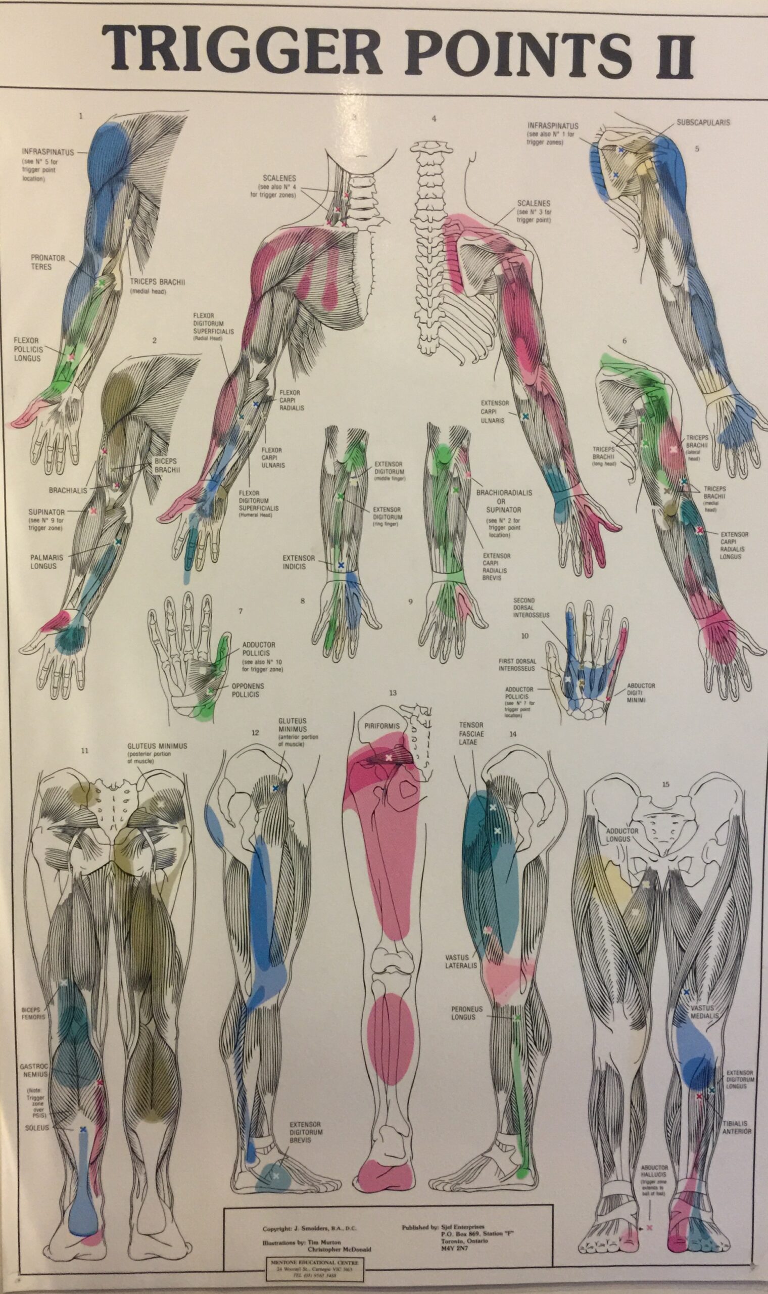 Trigger Point Therapy For Vertigo VertigoRX Vertigo Relief Wristbands